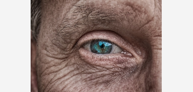 Les maladies de peau chez la personne âgée | Logement Seniors